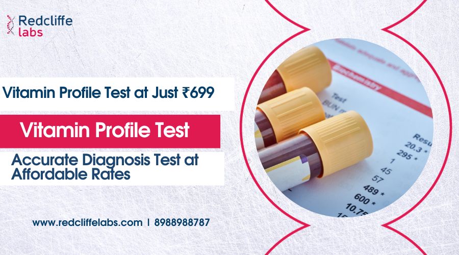 Vitamin Profile Test - Price, Procedure, Benefits 2023