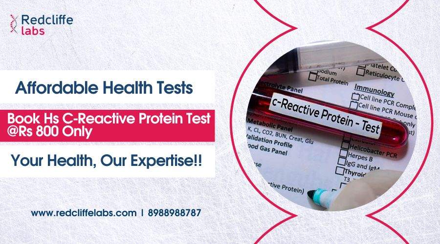 Hs-CRP (High Sensitivity C-reactive Protein) Test in Gaya