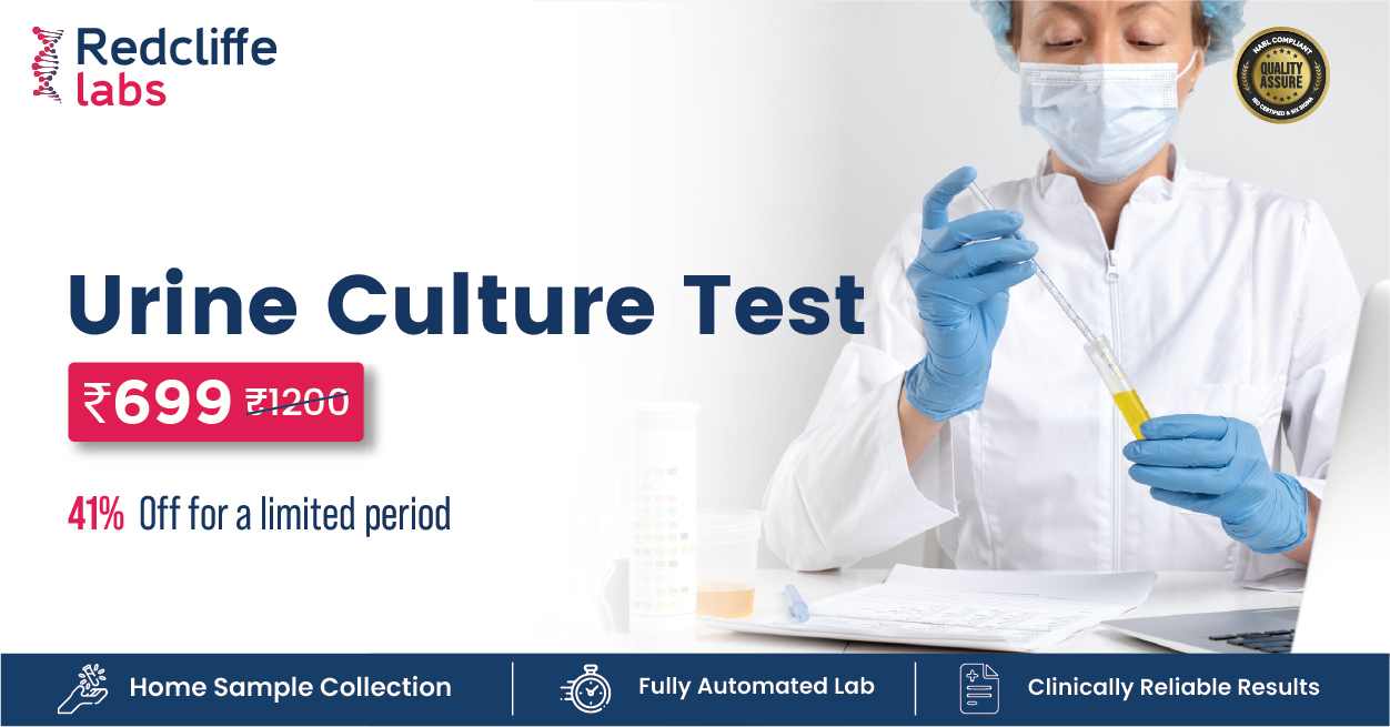 Urine Culture Test - Price, Preparation, Procedure, & Result 2025