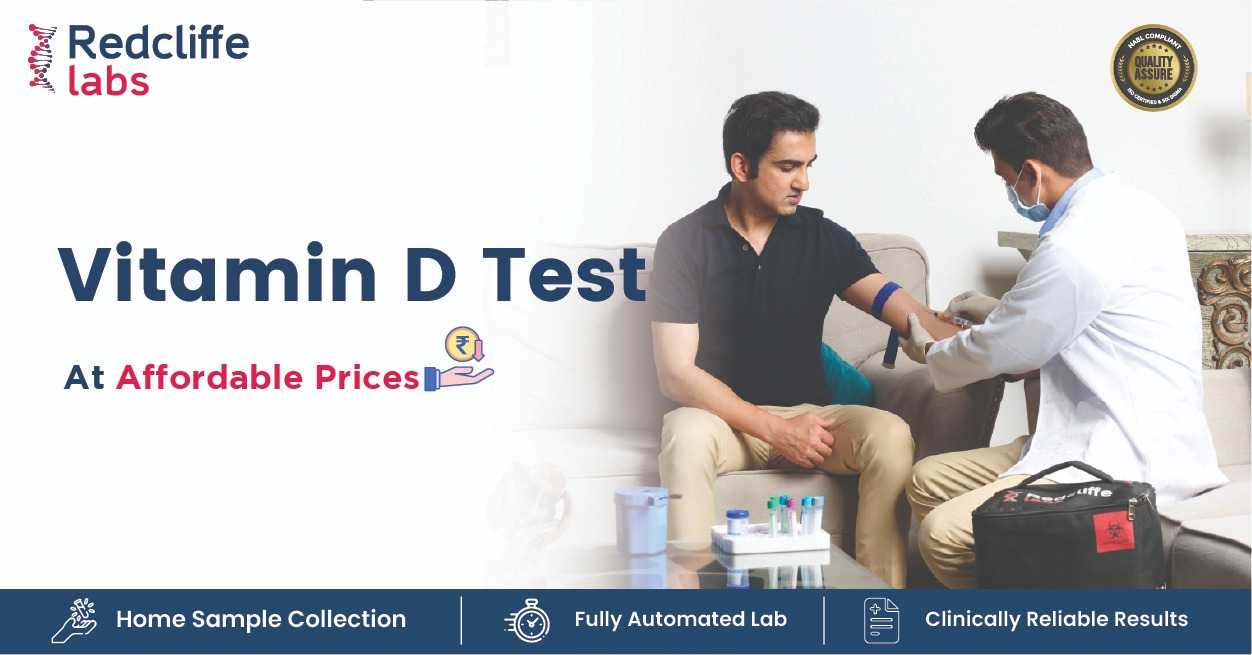 Book Vitamin D Test - Price, Purpose, Procedure, Normal Range