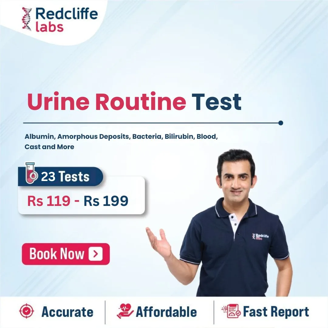 Urine Routine Test (Urine R/M Test) - Price, Procedure, Report