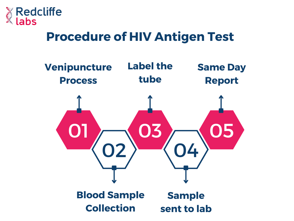 HIV Test Price Normal Range Preparation Procedure 2025