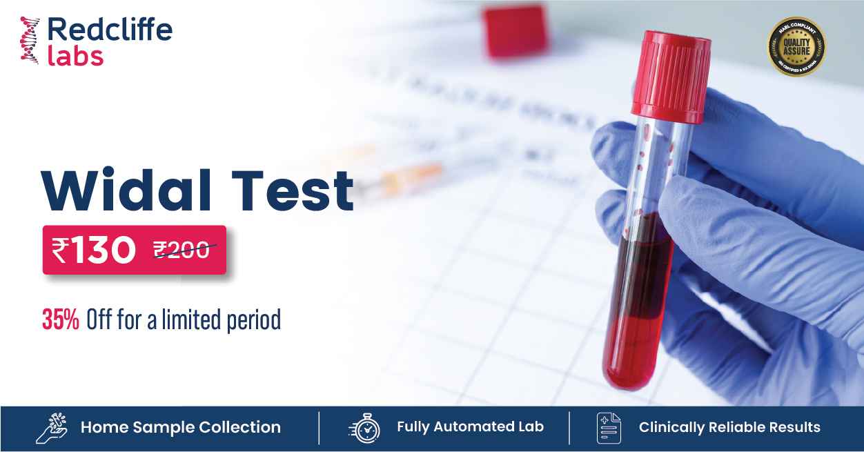 Widal Test: Price, Purpose, Procedure, Normal Values & Results